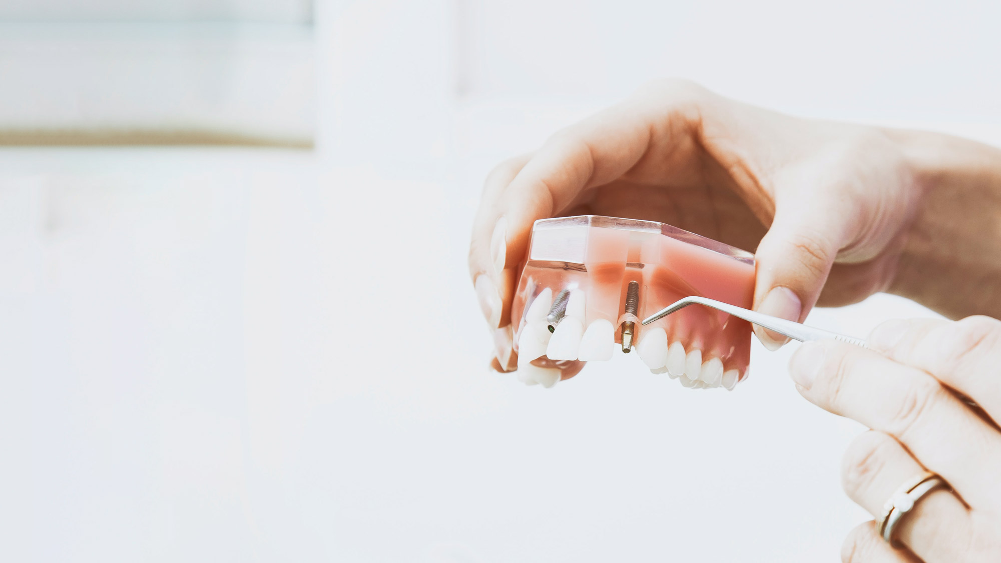 Precision Dental Implant Laboratory